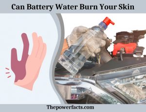 Can Battery Water Burn Your Skin? (What Does Battery Acid Do to Skin ...